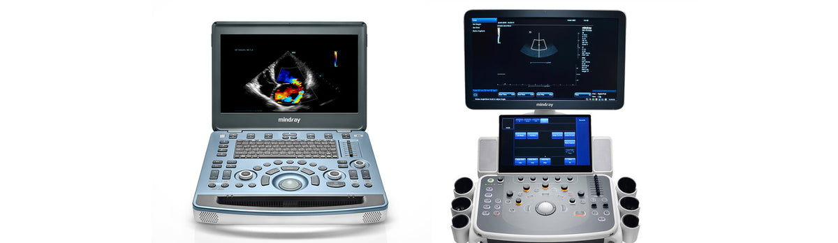 Portable vs. Console: Understanding the Different Types of Ultrasound ...