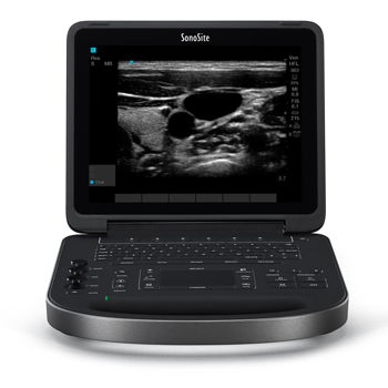 Sonosite Ultrasound Systems For Sale & Rental – Ultrasounds MD